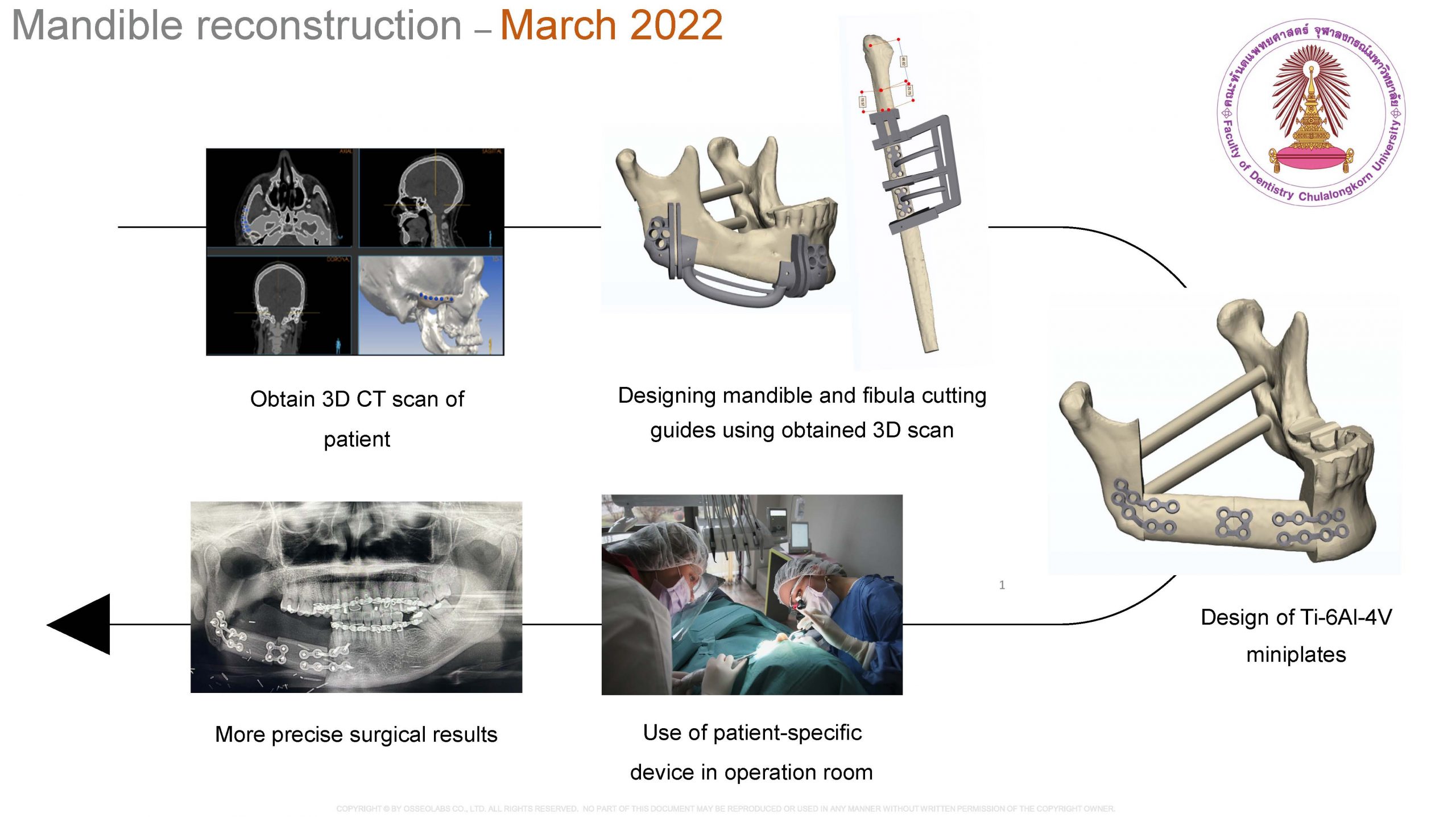“OsseoLabs” บริษัท Spin-off จากภาควิชาวิศวกรรมเครื่องกล มจธ. เพื่อต่อ ...